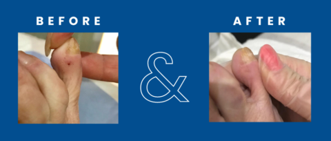 Treatments - Cutting Edge Podiatry